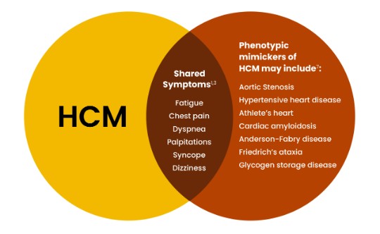 Understanding Hypertrophic Cardiomyopathy | Expose HCM