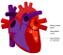Understanding Hypertrophic Cardiomyopathy | Expose HCM